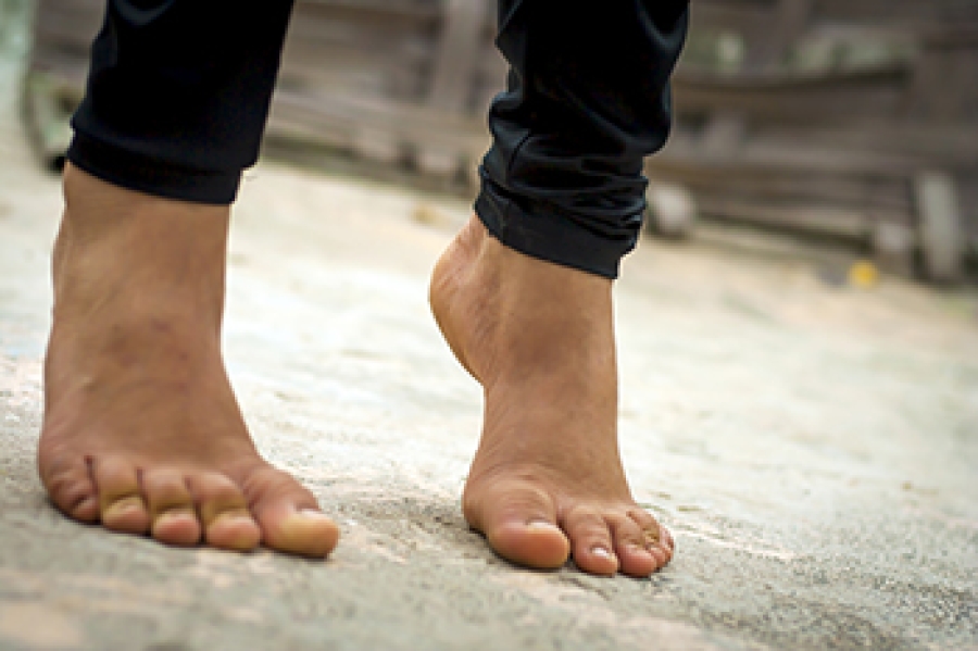 How Do Podiatrists Treat Plantar Hyperhidrosis?